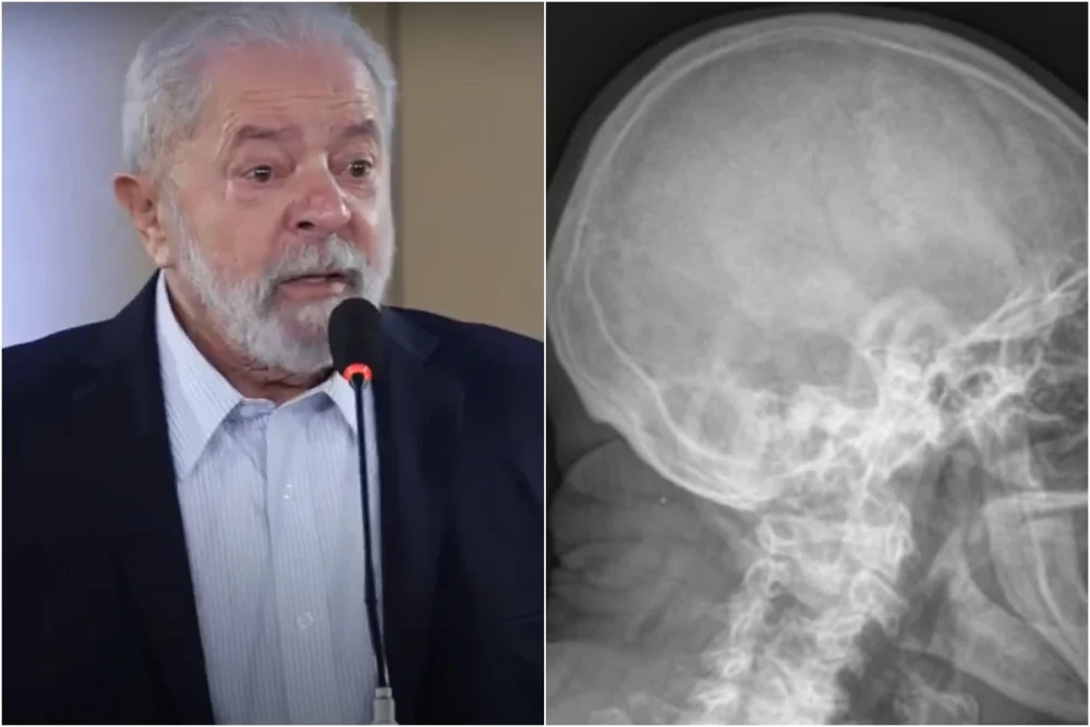 Corto-Contuso: o que é e quais podem ser as consequências de ferimento ...