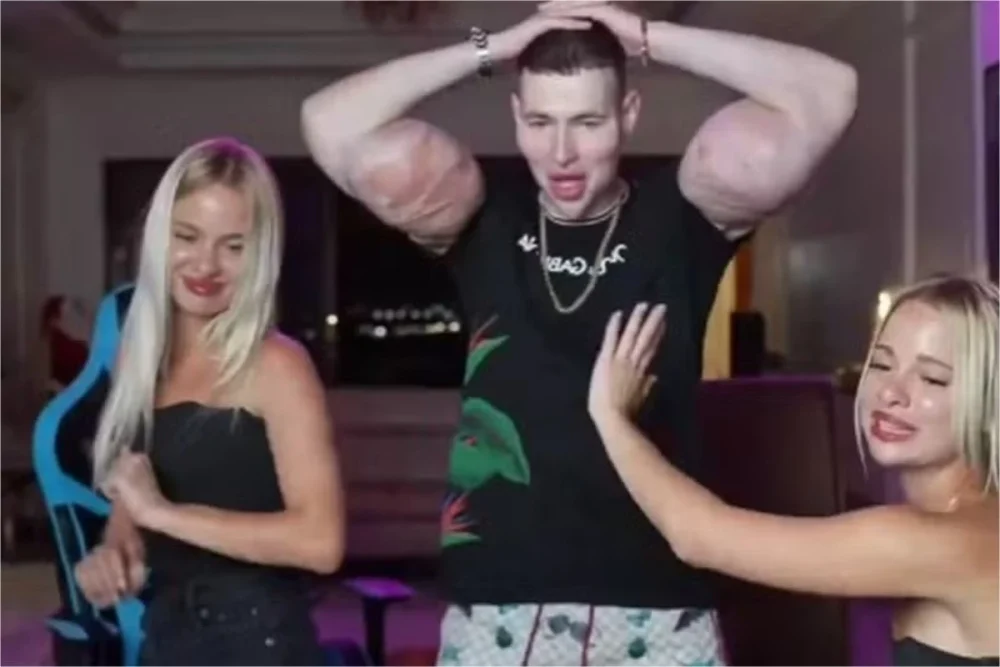 'Popeye russo' aparece entre modelos e ganha conselho inusitado dos fãs