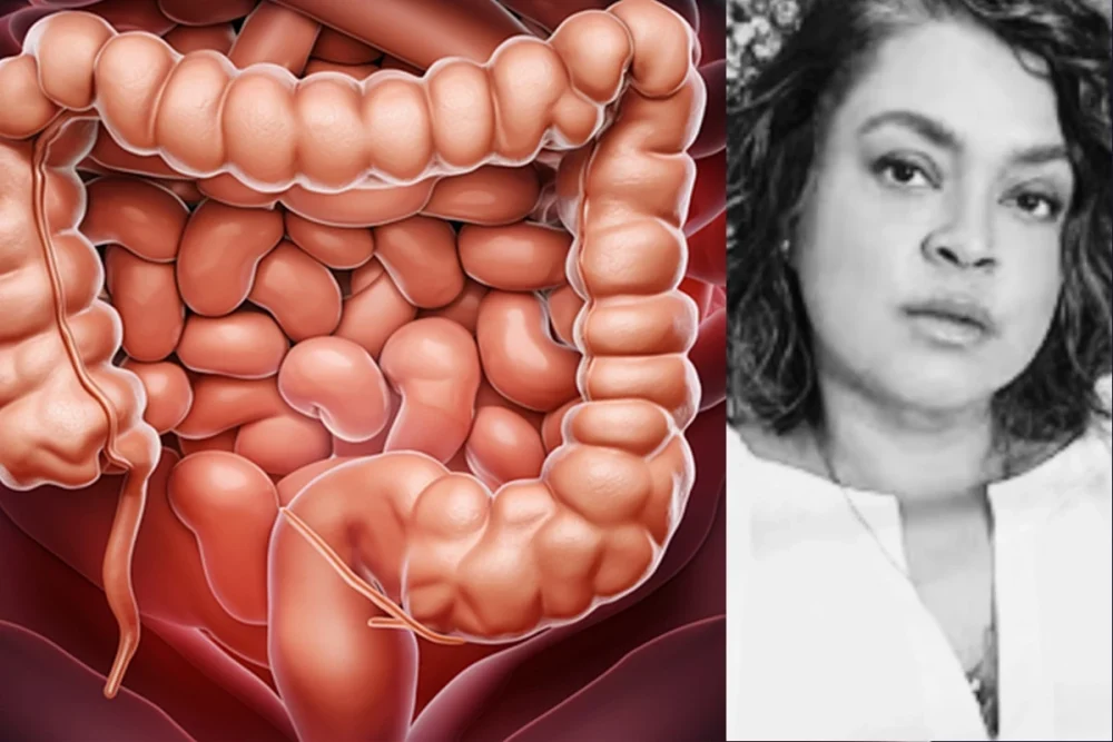 Câncer como o que vitimou Preta Gil tem grande chance de cura e vem registrando aumento de casos ...